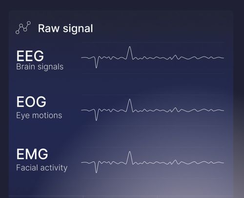 FRENZ™ by Earable™ Neuroscience